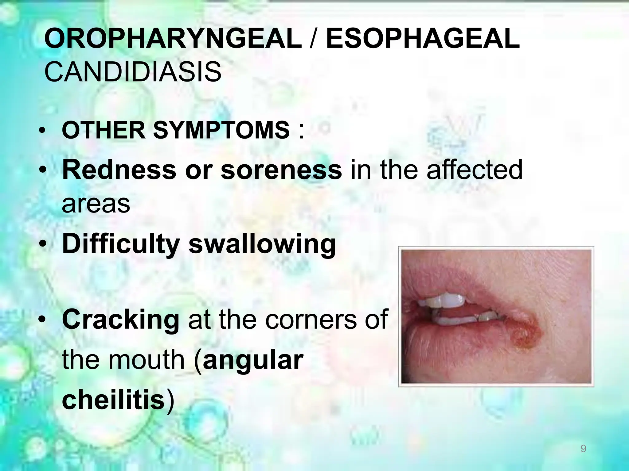 My presentation on Candida/FUNGAL INFECTIONS.pptx