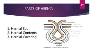 HERNIA and its types | PPTX