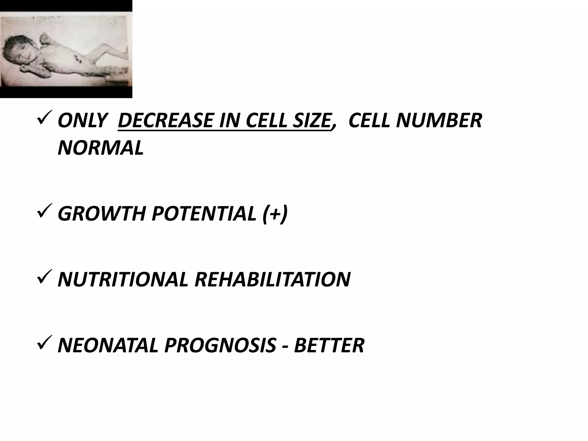SMALL FOR GESTATIONAL AGE,LARGE FOR GESTATIONAL AGE -SSJ, CALICUT ...