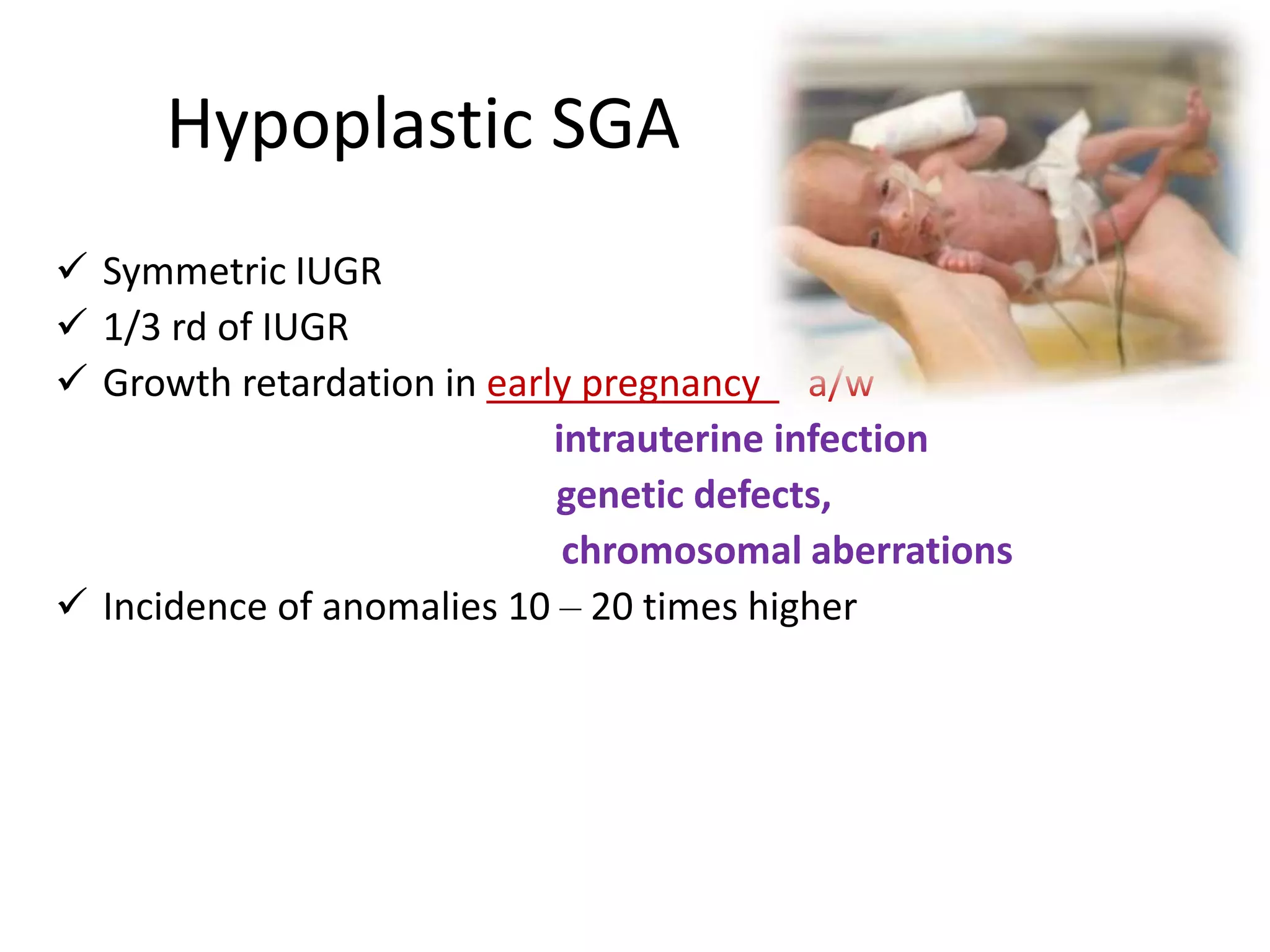 SMALL FOR GESTATIONAL AGE,LARGE FOR GESTATIONAL AGE -SSJ, CALICUT ...