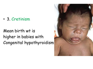 SMALL FOR GESTATIONAL AGE,LARGE FOR GESTATIONAL AGE -SSJ, CALICUT ...