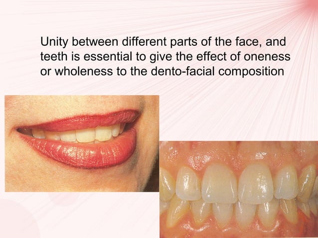 principles of smile designing dr.rinku | PPT