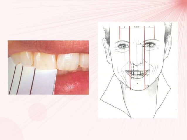 principles of smile designing dr.rinku | PPT | Dental Health | Diseases ...