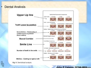 principles of smile designing dr.rinku | PPT