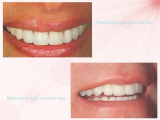 principles of smile designing dr.rinku | PPT