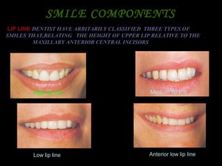 principles of smile designing dr.rinku | PPT