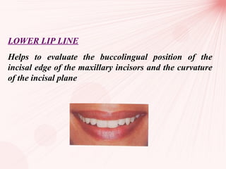 principles of smile designing dr.rinku | PPT