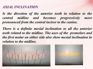 principles of smile designing dr.rinku | PPT