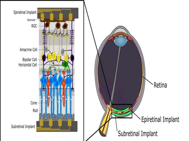 medical biometry | PPTX