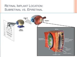 medical biometry | PPTX