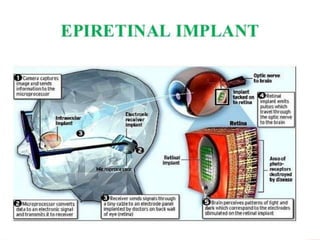 medical biometry | PPTX