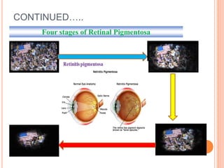 medical biometry | PPTX