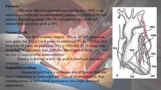 Coronary Artery Bypass Grafting by Abdullah Waheed.pptx