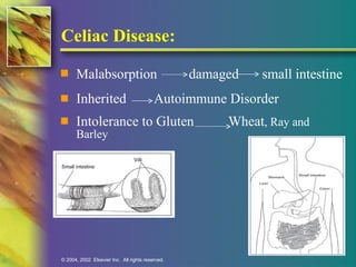 celiac disease | PPT
