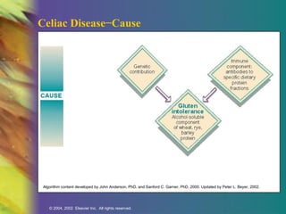 celiac disease | PPT