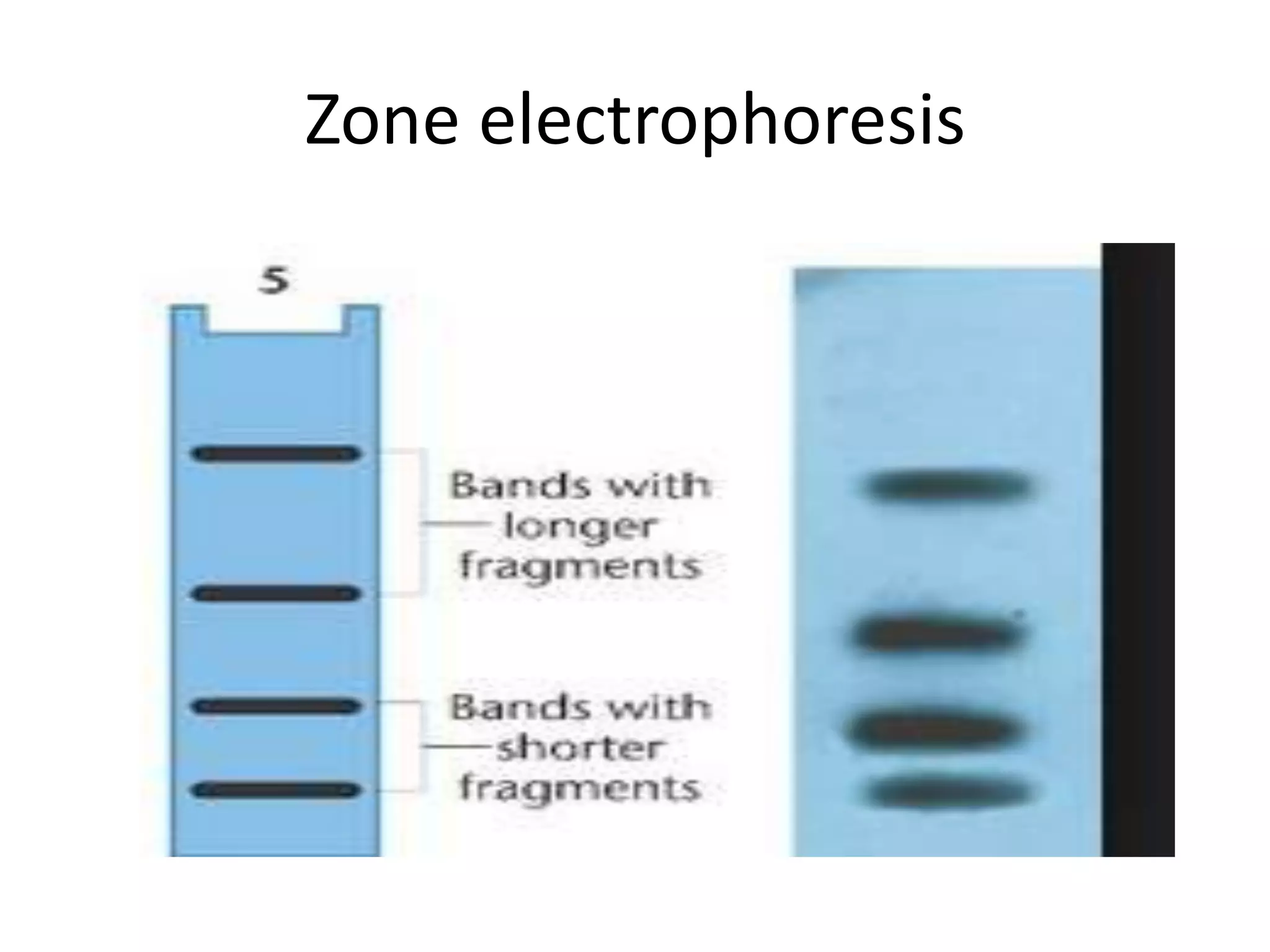 Essentials in Protein Electrophoresis | PPTX