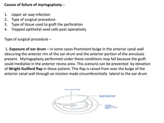 Myringoplasty ppt | PPTX