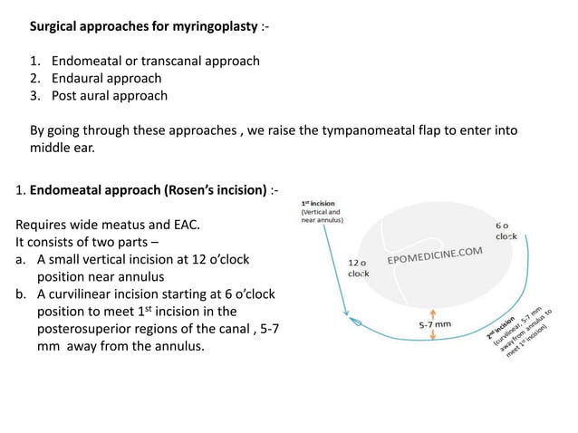 Myringoplasty ppt | PPTX