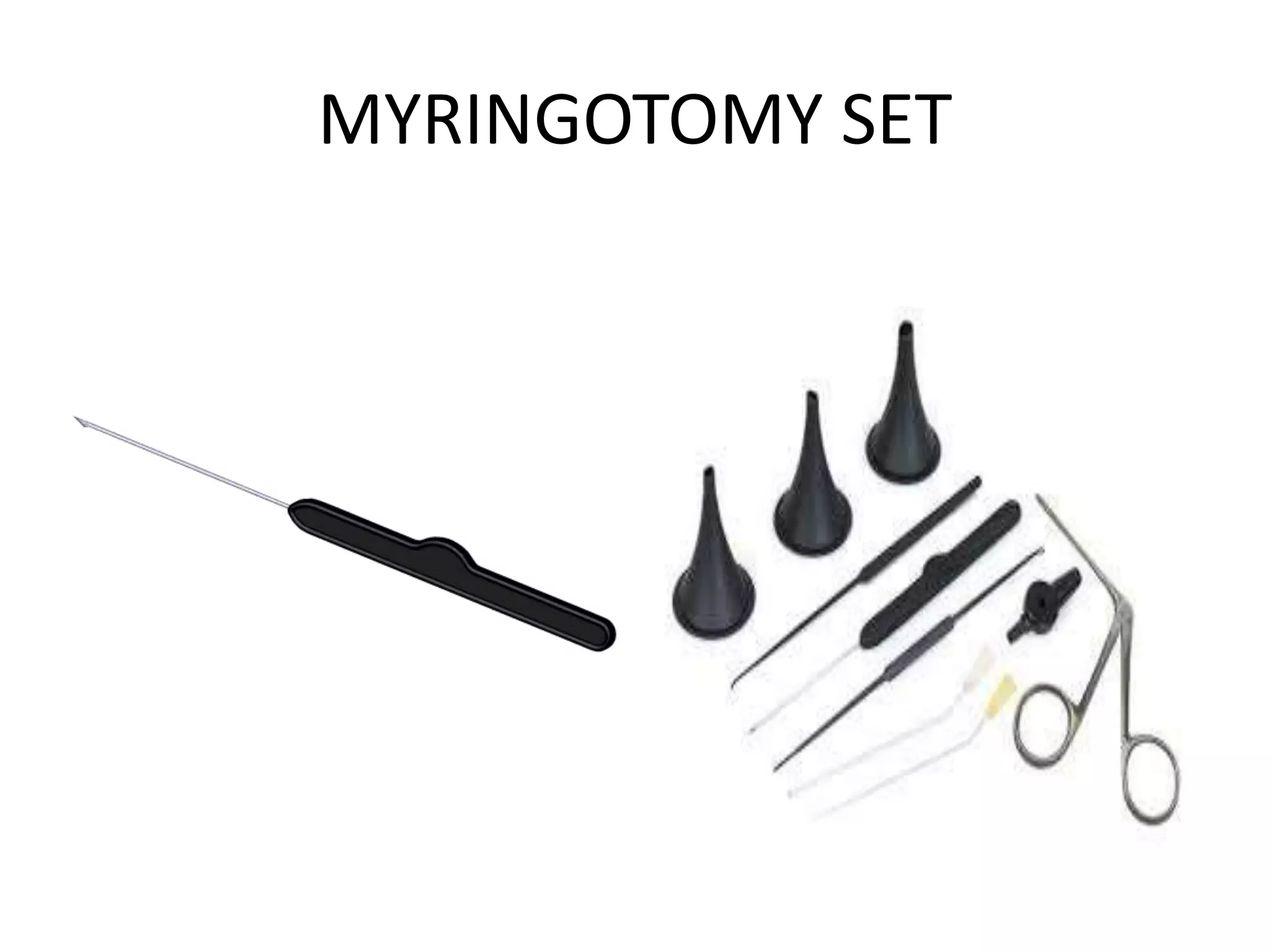 Myringotomy and grommet insertion | PPTX