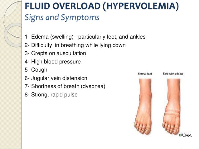 IV FLUIDS AND BLOOD IN RESUSCITATION