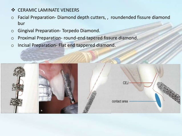 Rotary Cutting Instruments in Fixed & Removable Prosthodontics | PPTX ...