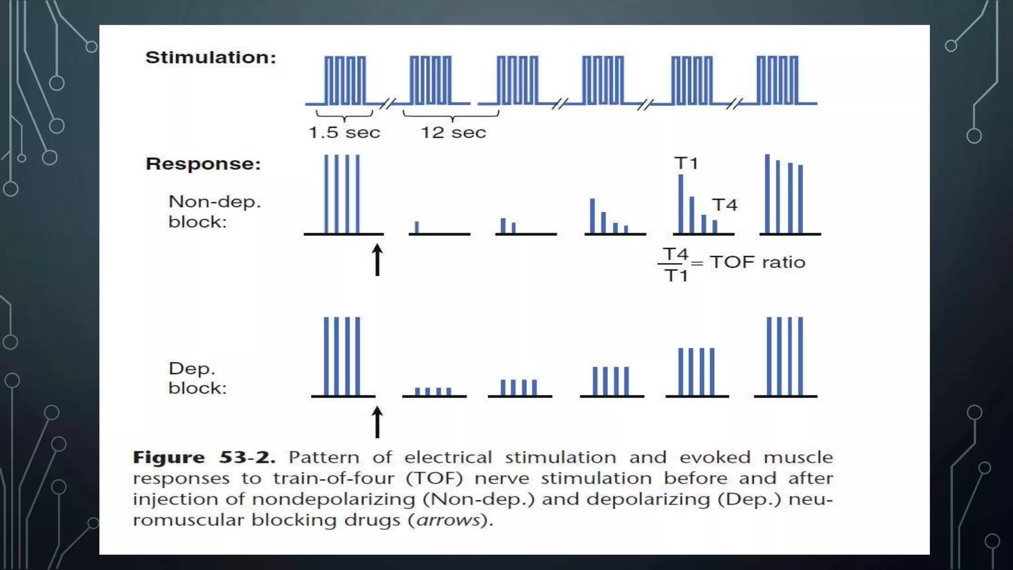 NEUROMUSCULAR MONITORING | PPTX