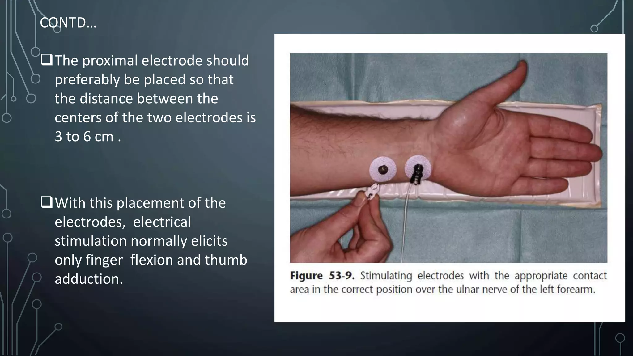 NEUROMUSCULAR MONITORING | PPTX
