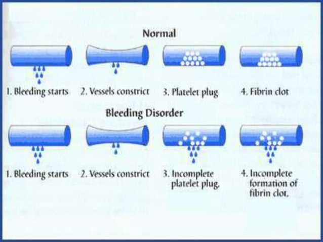 hemorrhagic disease of newborn | PPTX