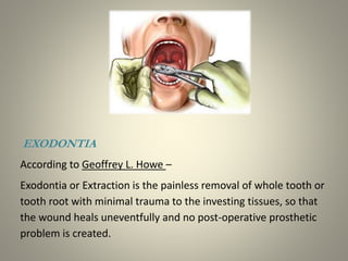 Complications of EXODONTIA | PPTX