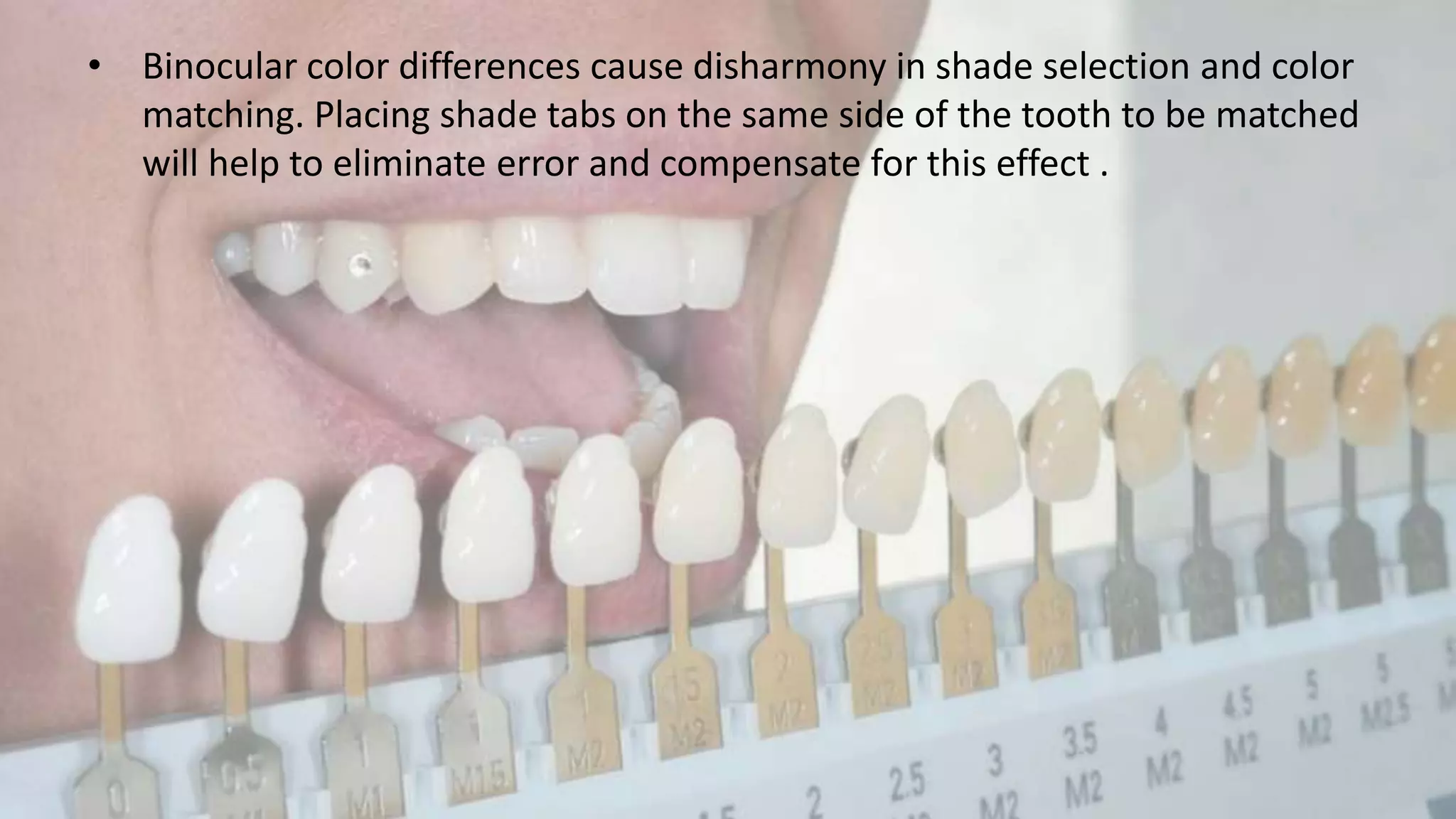 Shade selection in FPD | PPTX
