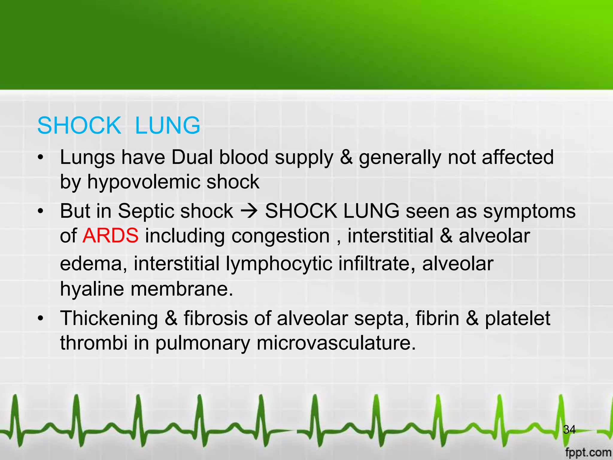 SHOCK | PPTX