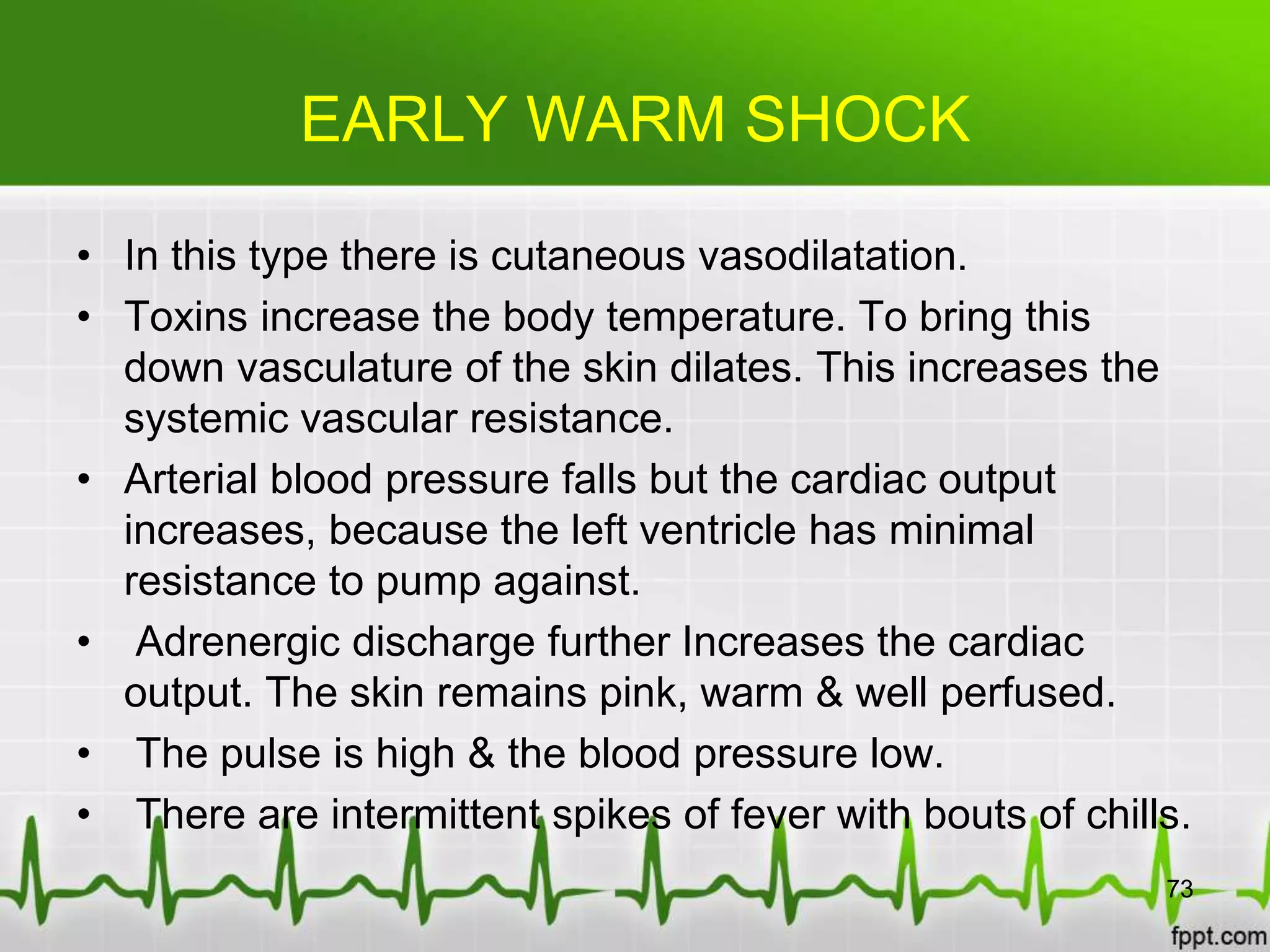 SHOCK | PPTX