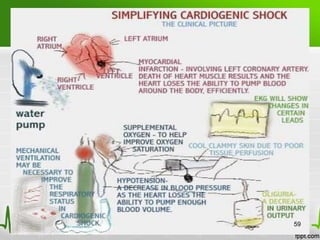 SHOCK | PPTX