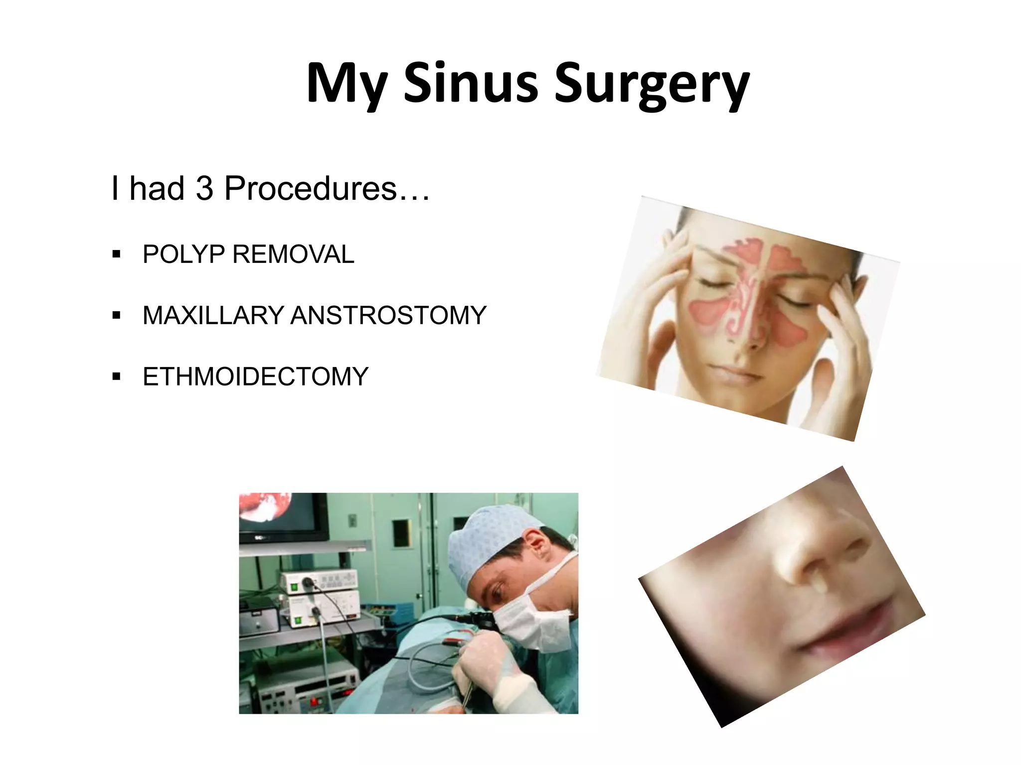 My sinus surgery | PPTX