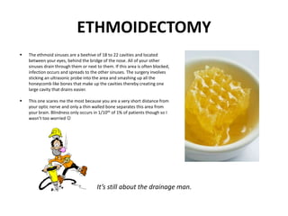 My sinus surgery | PPTX