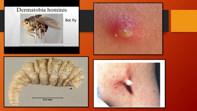 Myiasis ....a parasitic disease. | PPTX