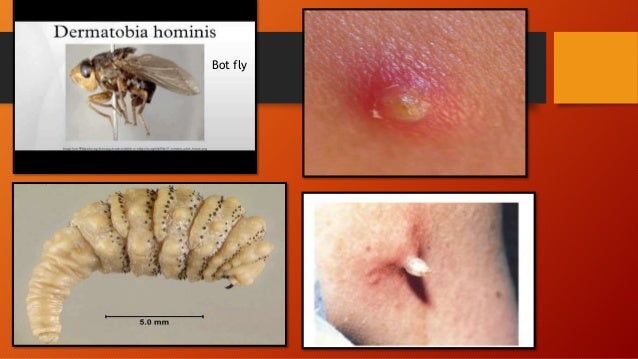 Myiasis ....a parasitic disease.