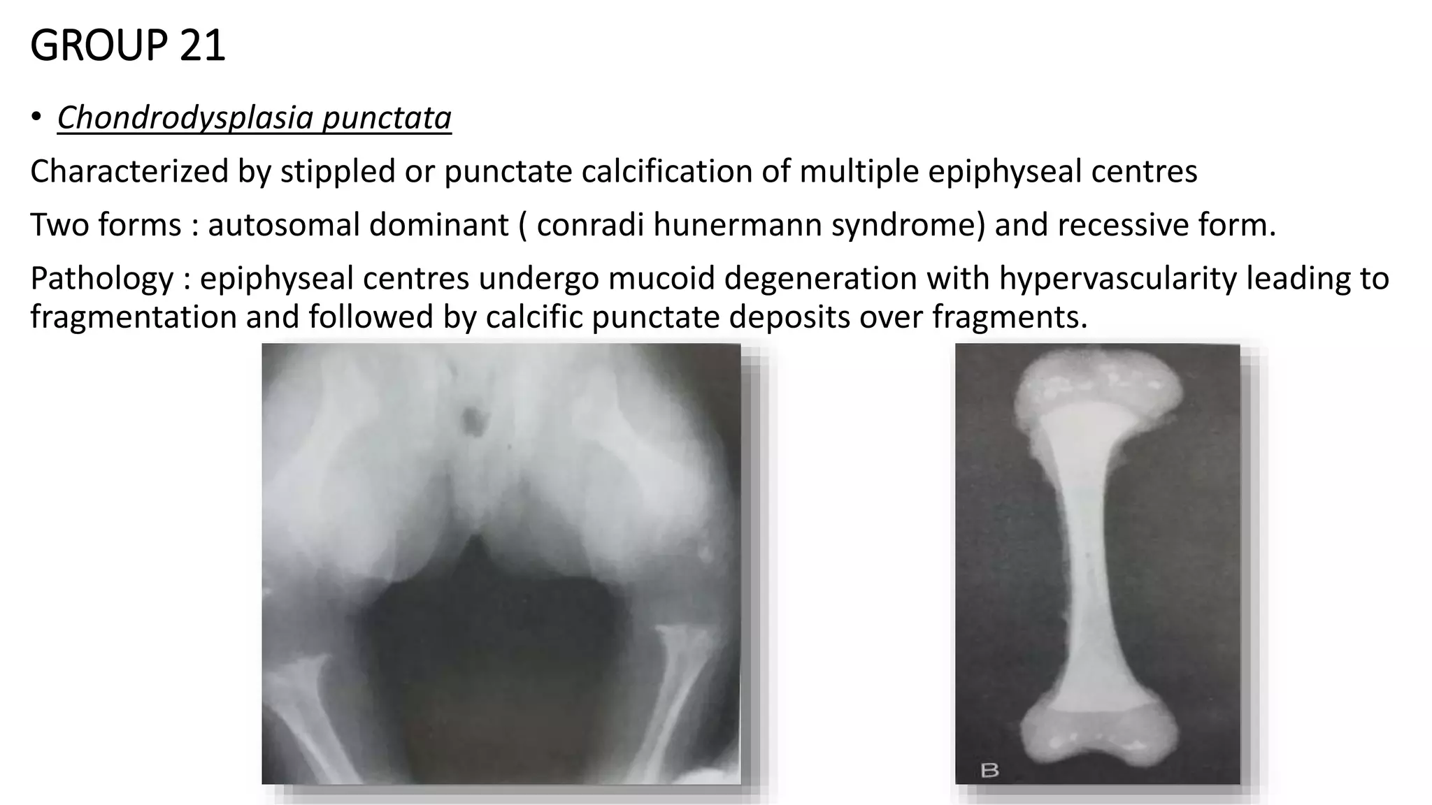 skeletal dysplasia ppt | PPTX