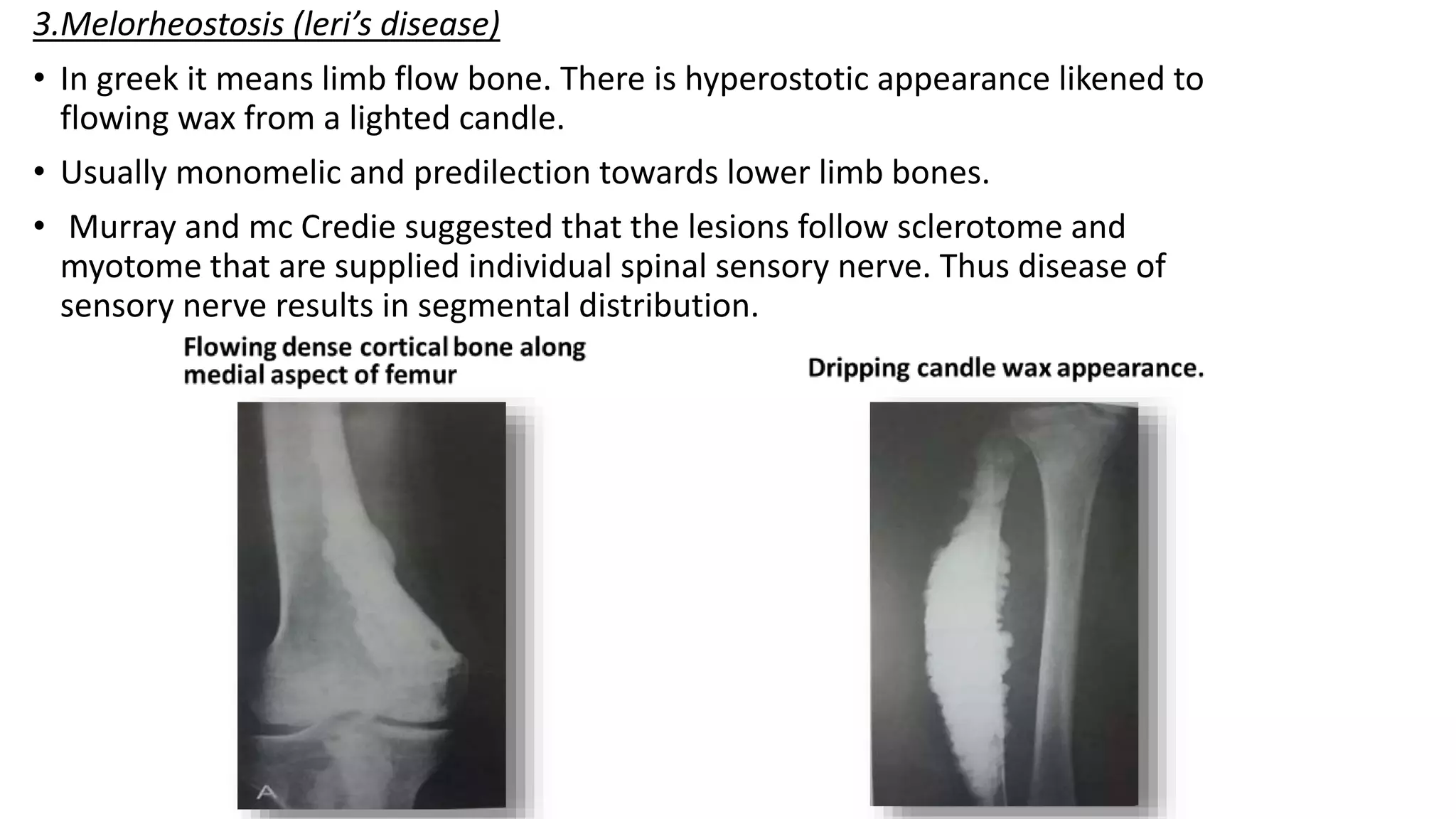 skeletal dysplasia ppt | PPTX