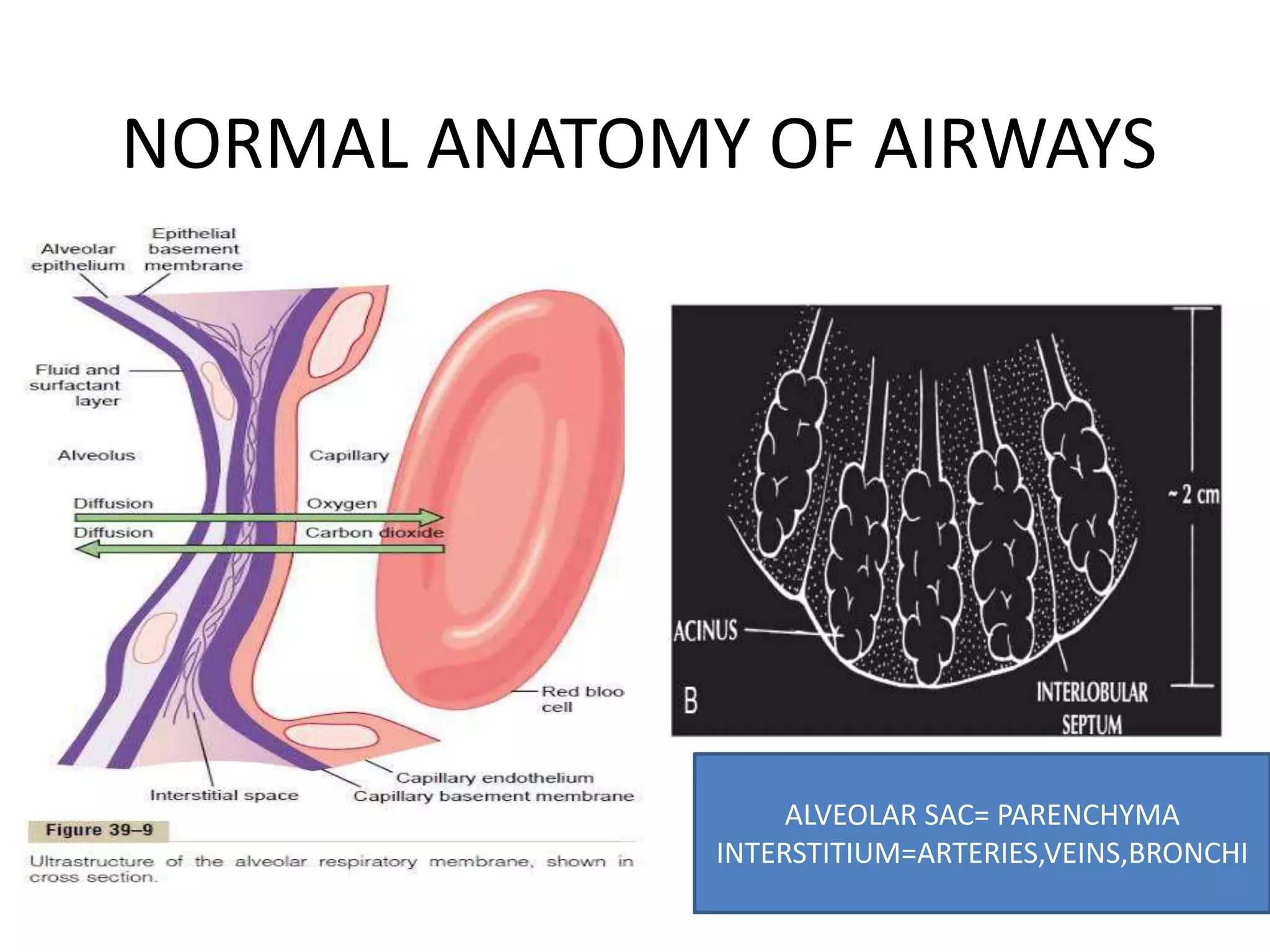 chest x ray alveolar diseases.pptx