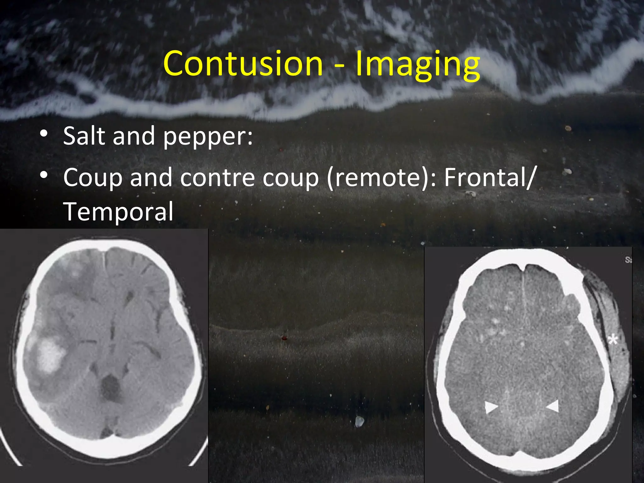 Surgery for Head Injury | PPT