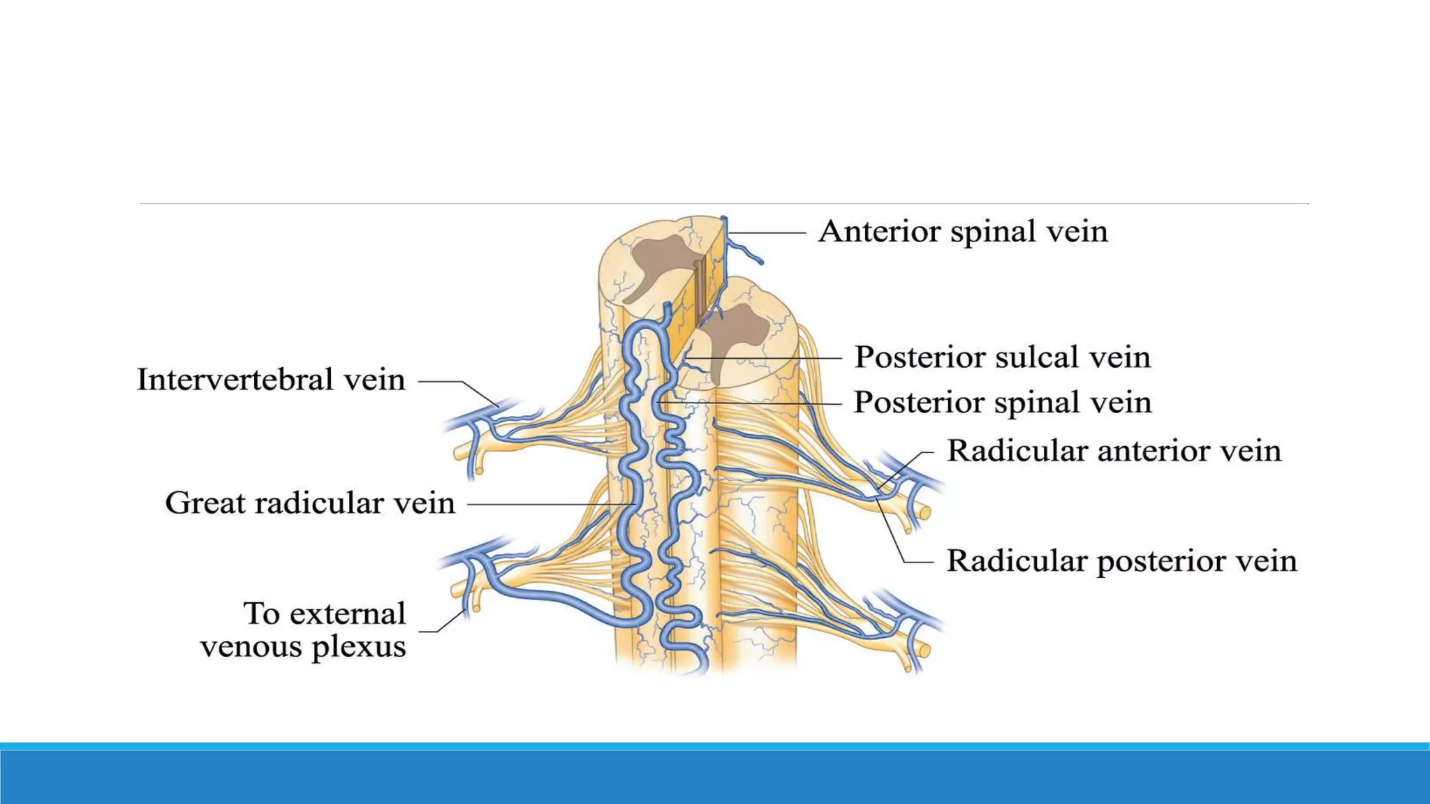 spinal angiography with spnal av anomalies | PPTX
