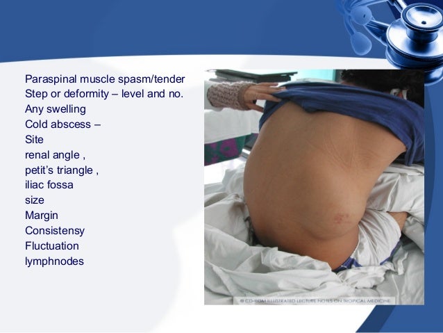 clinical examination of spine