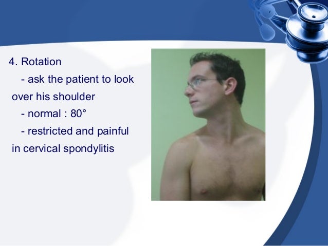 clinical examination of spine