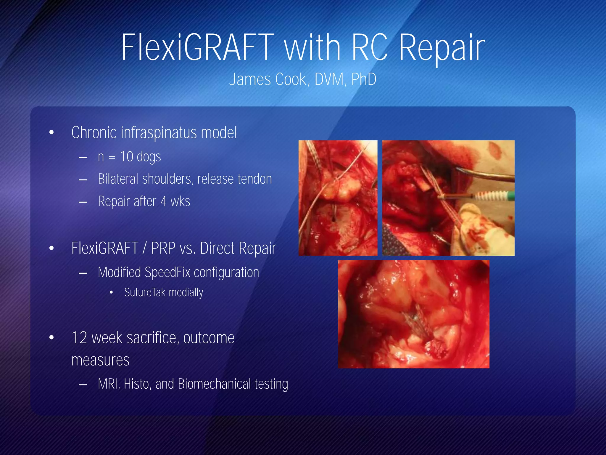 My Techniques for Shoulder Joint Preservation | PDF