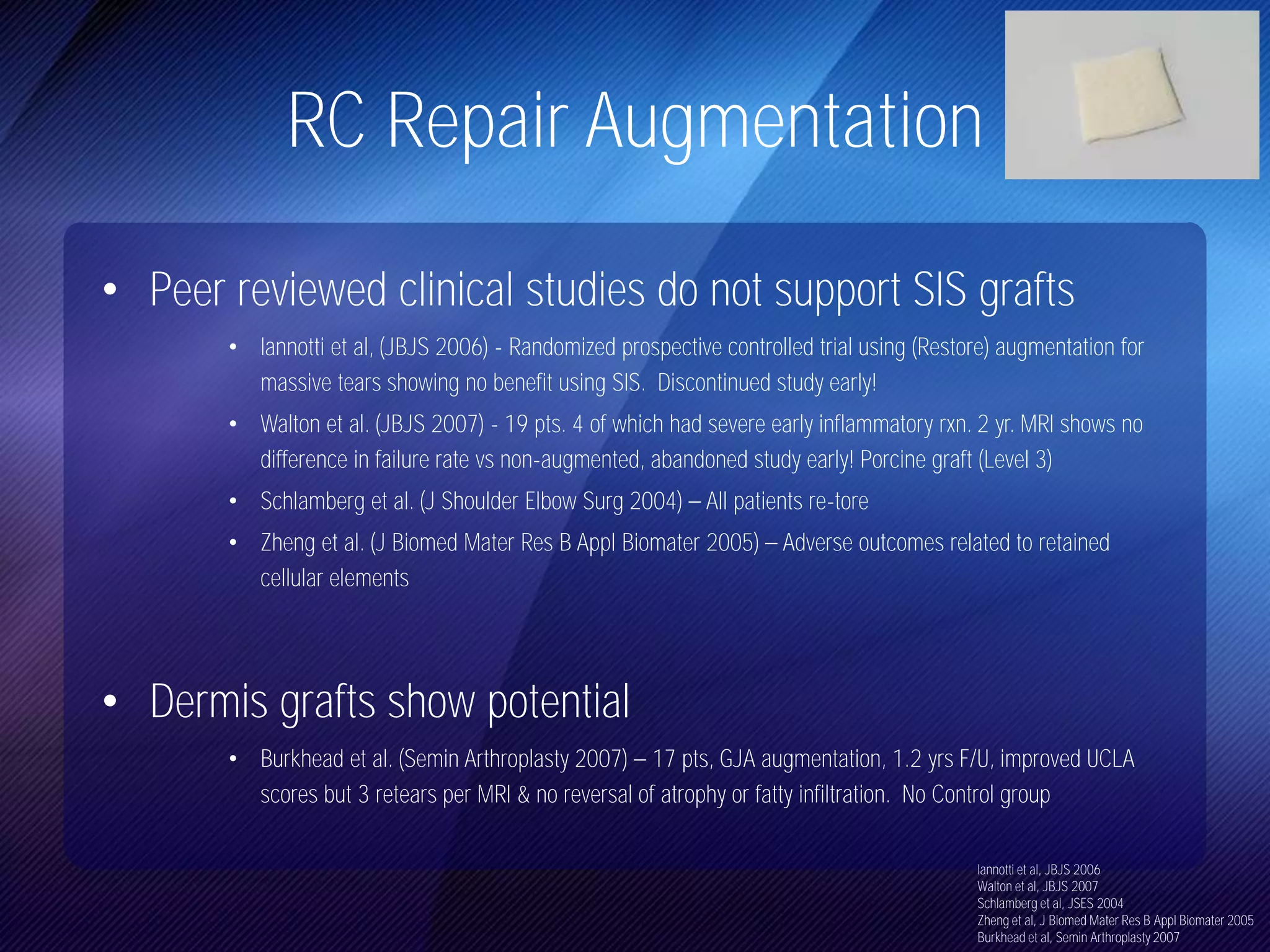 My Techniques for Shoulder Joint Preservation | PDF