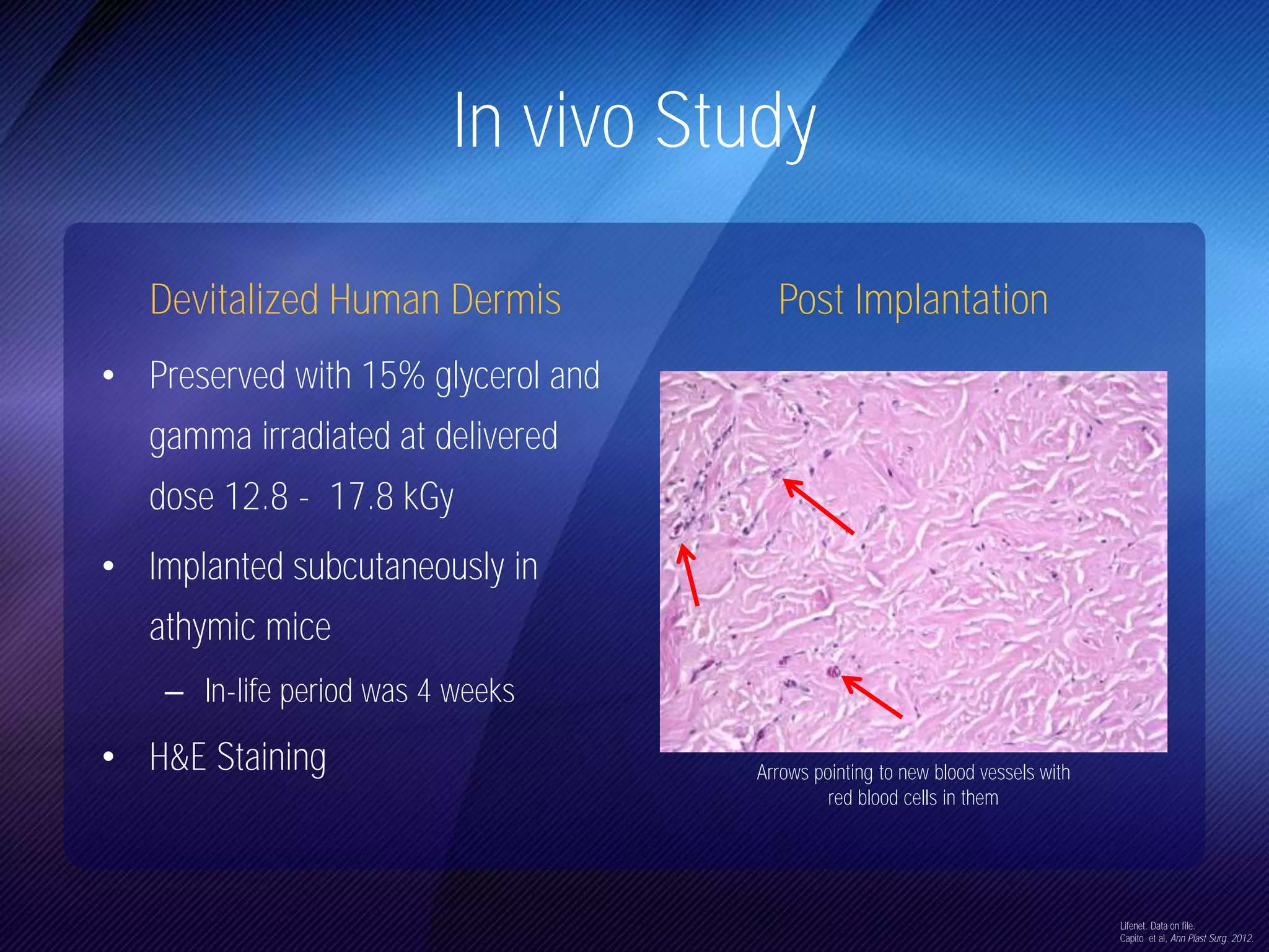 My Techniques for Shoulder Joint Preservation | PDF