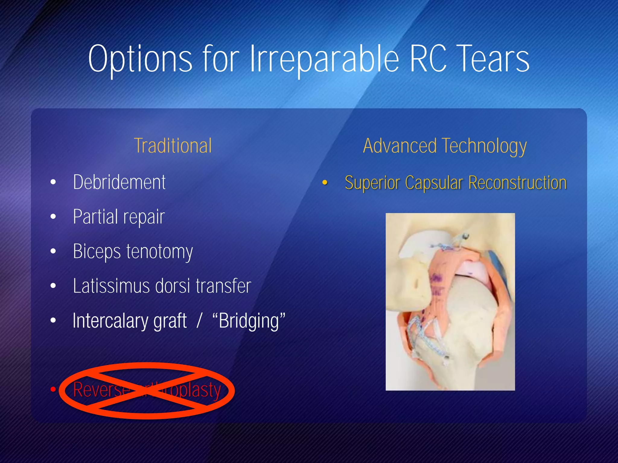 My Techniques for Shoulder Joint Preservation | PDF