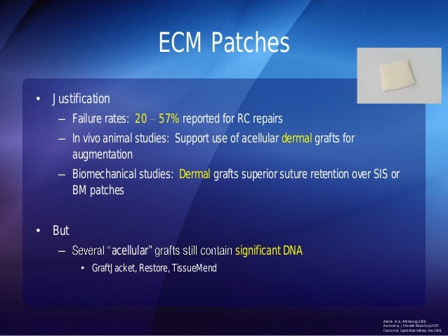 My Techniques for Shoulder Joint Preservation