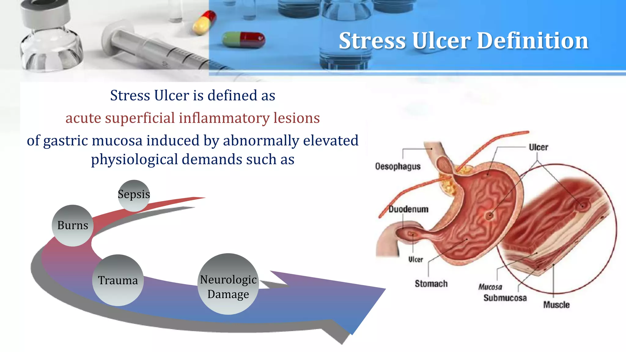 Overuse of Stress Ulcer prophylaxis (SUP) | PPTX